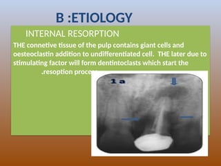 ENDODONTIC ASPECT ROOT RESORPTION dental.pptx