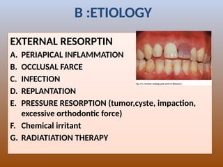 ENDODONTIC ASPECT ROOT RESORPTION dental.pptx