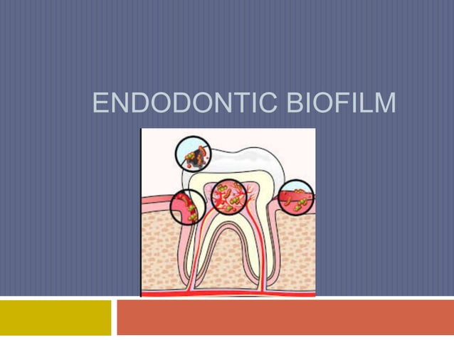 Endodontic biofilm | PPTX | Dental Health | Diseases and Conditions