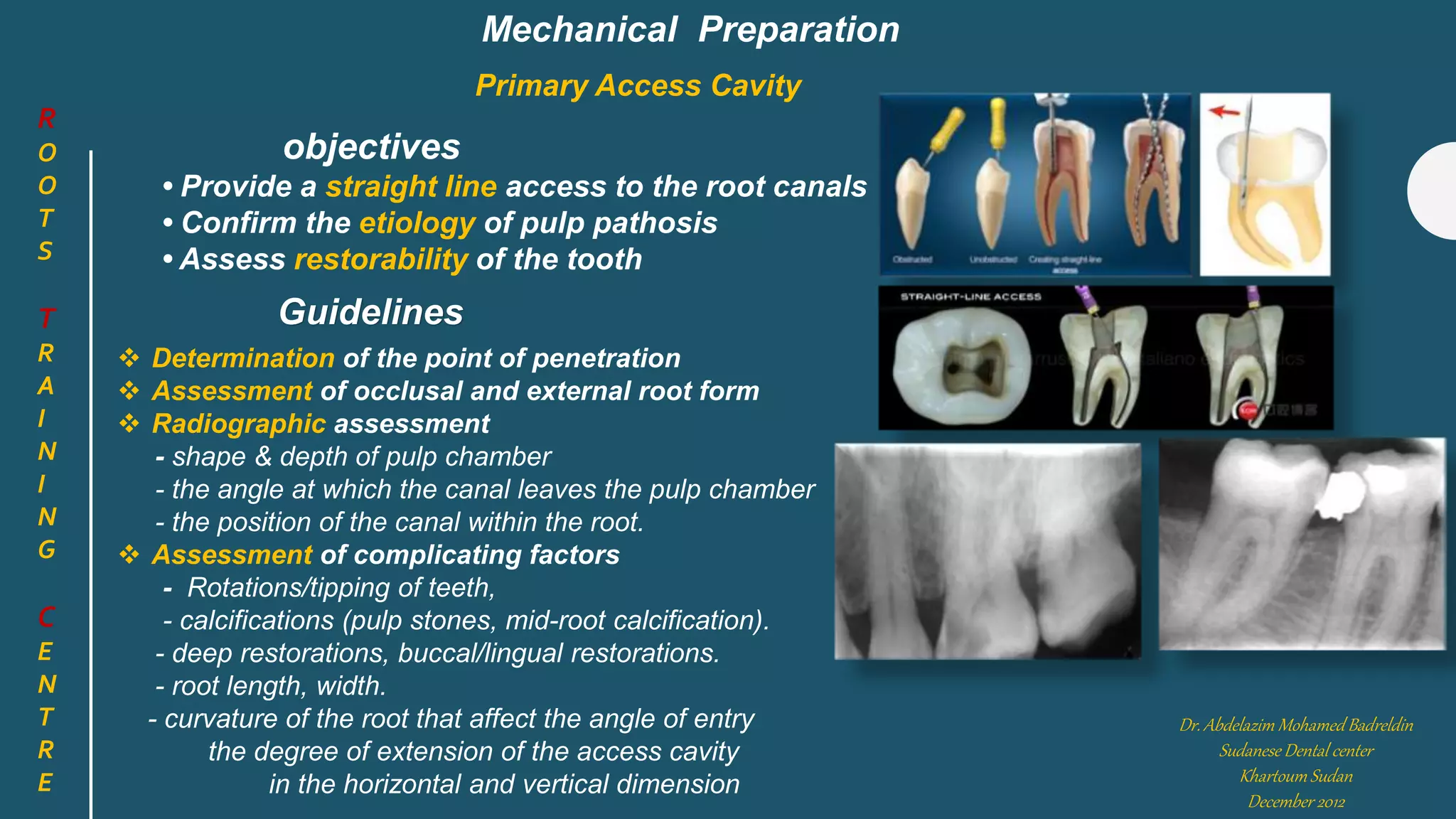 Endodontic canal preparation | PPTX
