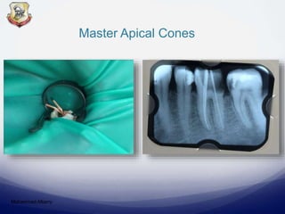 Endodontics Case Presentation | PPTX