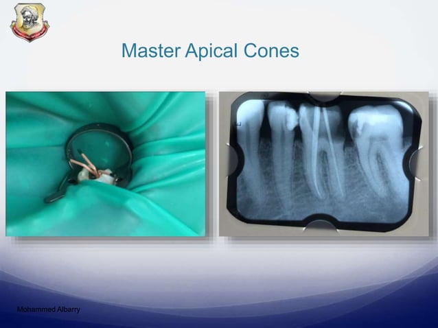 Endodontics Case Presentation | PPTX