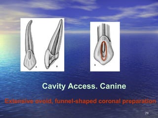 Endodontic cavity preparation | PPT