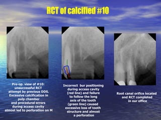 Endodontic Clinical Cases | PPT