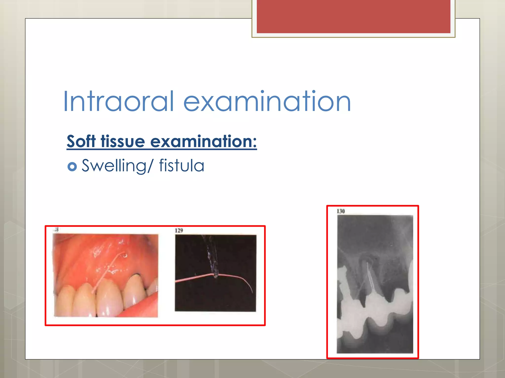 Endodontic diagnosis | PPTX