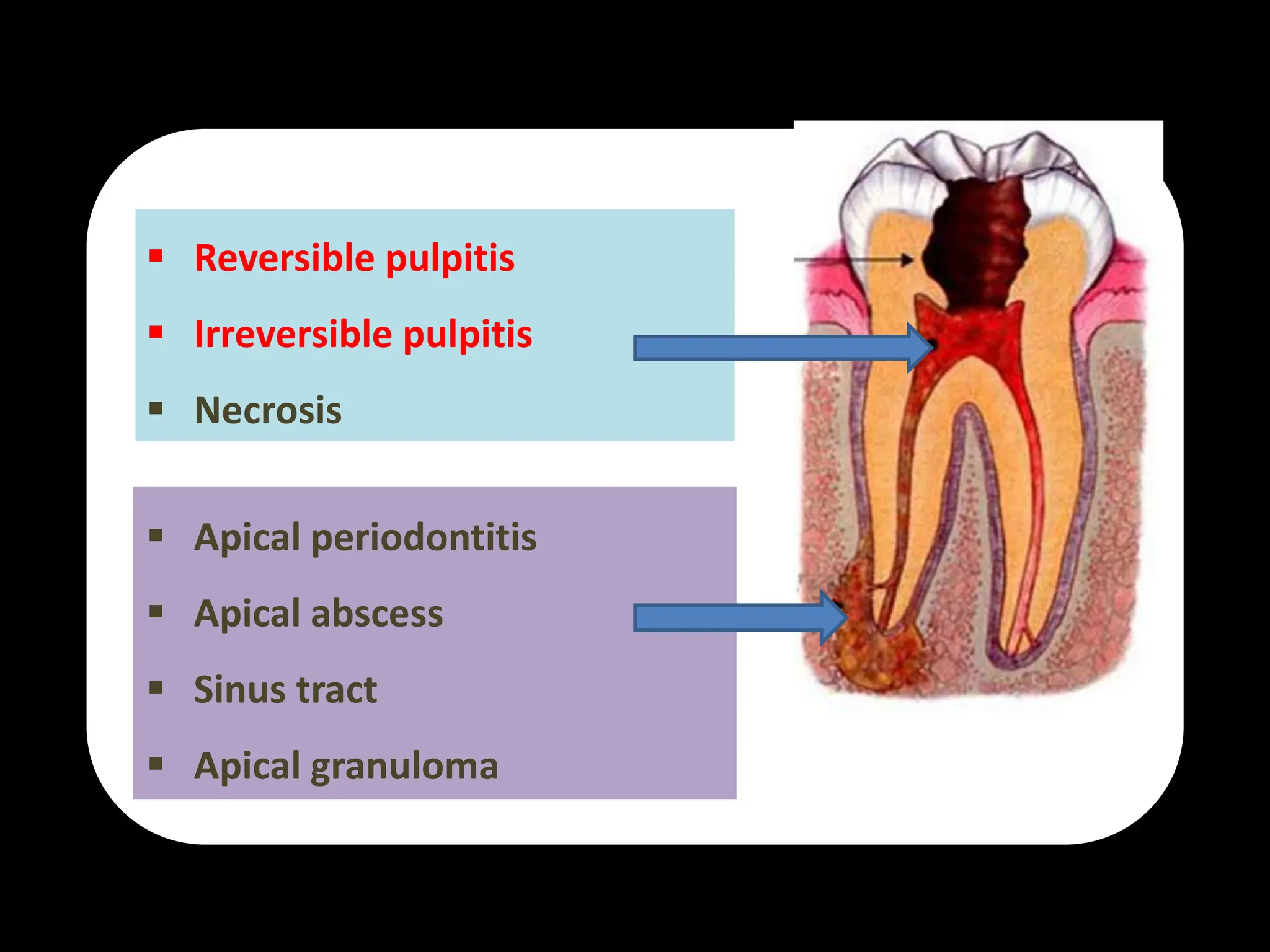 Endodontic Diagnosis. first part in diagnosispptx | PPTX