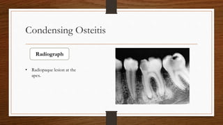 endodonticdiagnosisandtreatmentplanning-160625160151.pdf