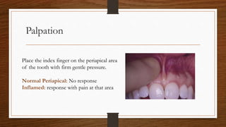 endodonticdiagnosisandtreatmentplanning-160625160151.pdf