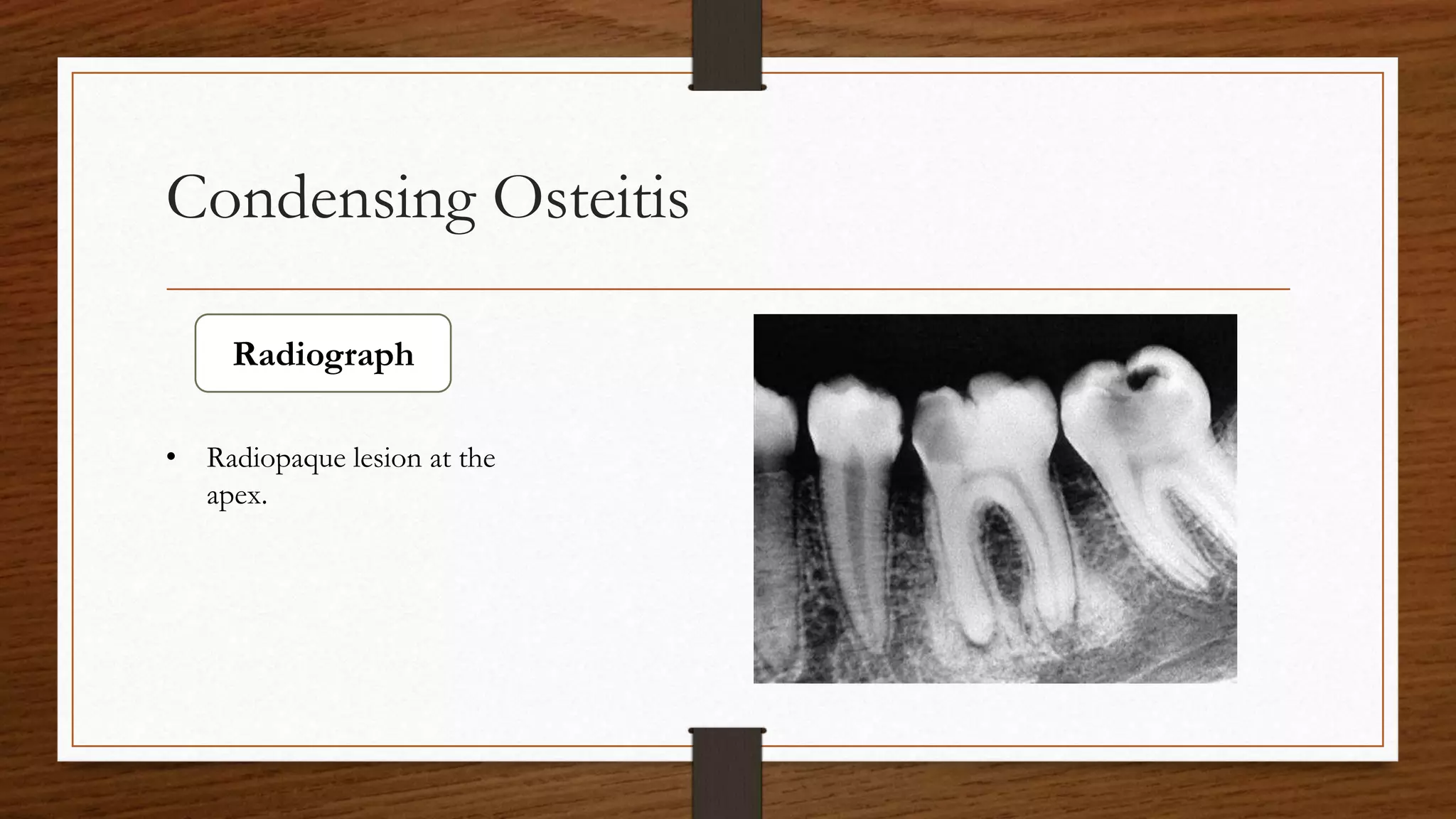 Endodontic Diagnosis and Treatment Planning | PPTX