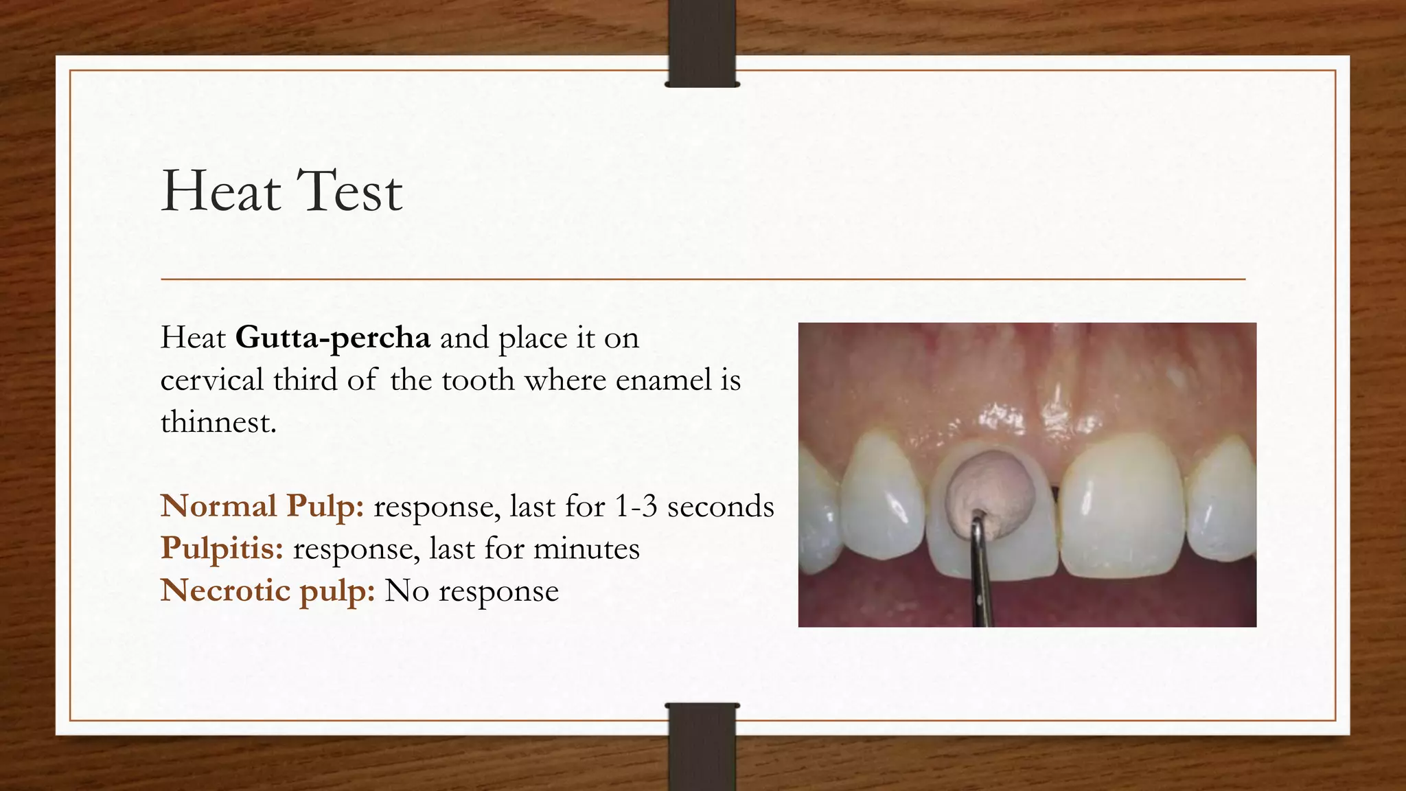 Endodontic Diagnosis and Treatment Planning | PPTX