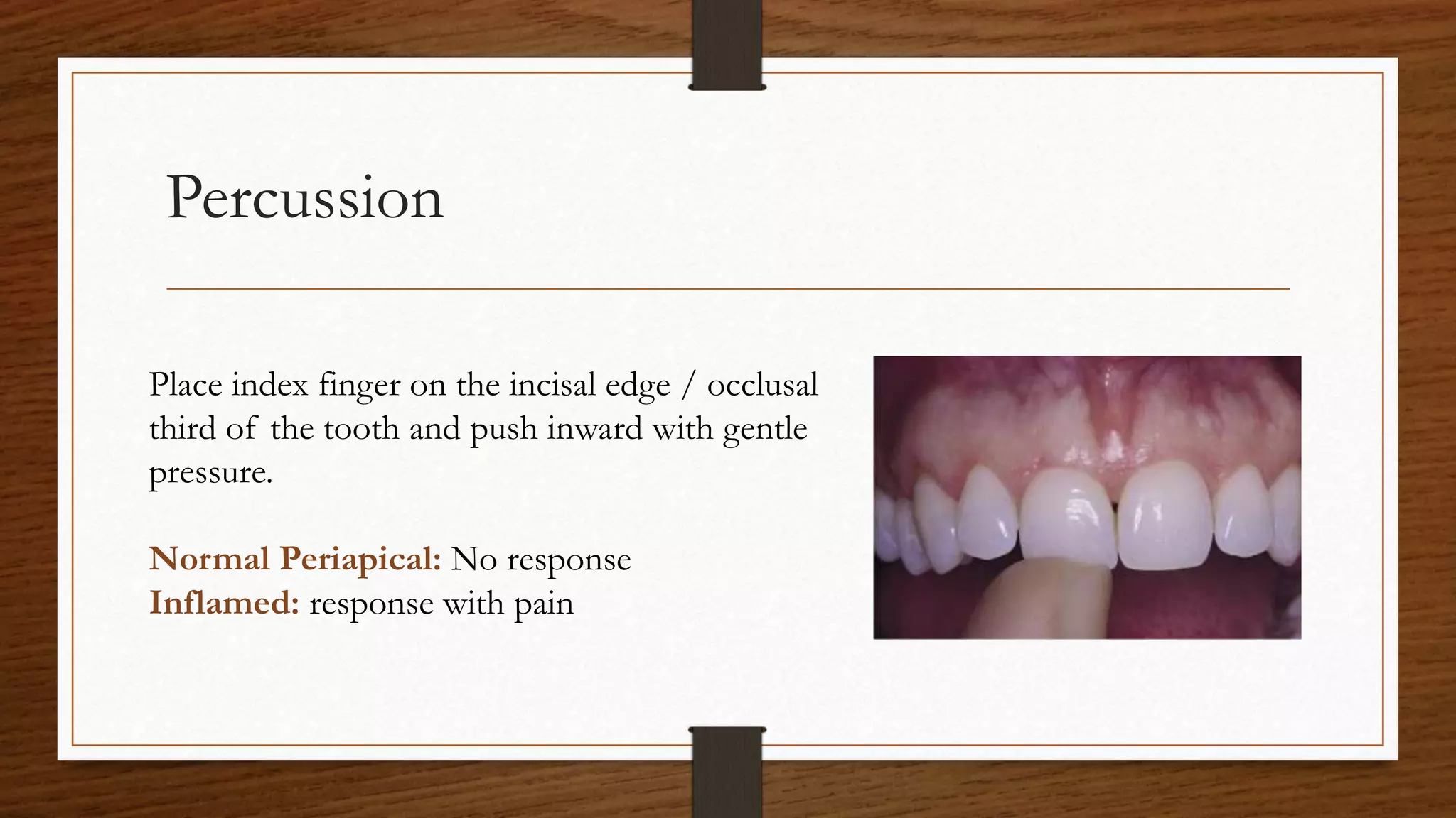 Endodontic Diagnosis and Treatment Planning | PPTX