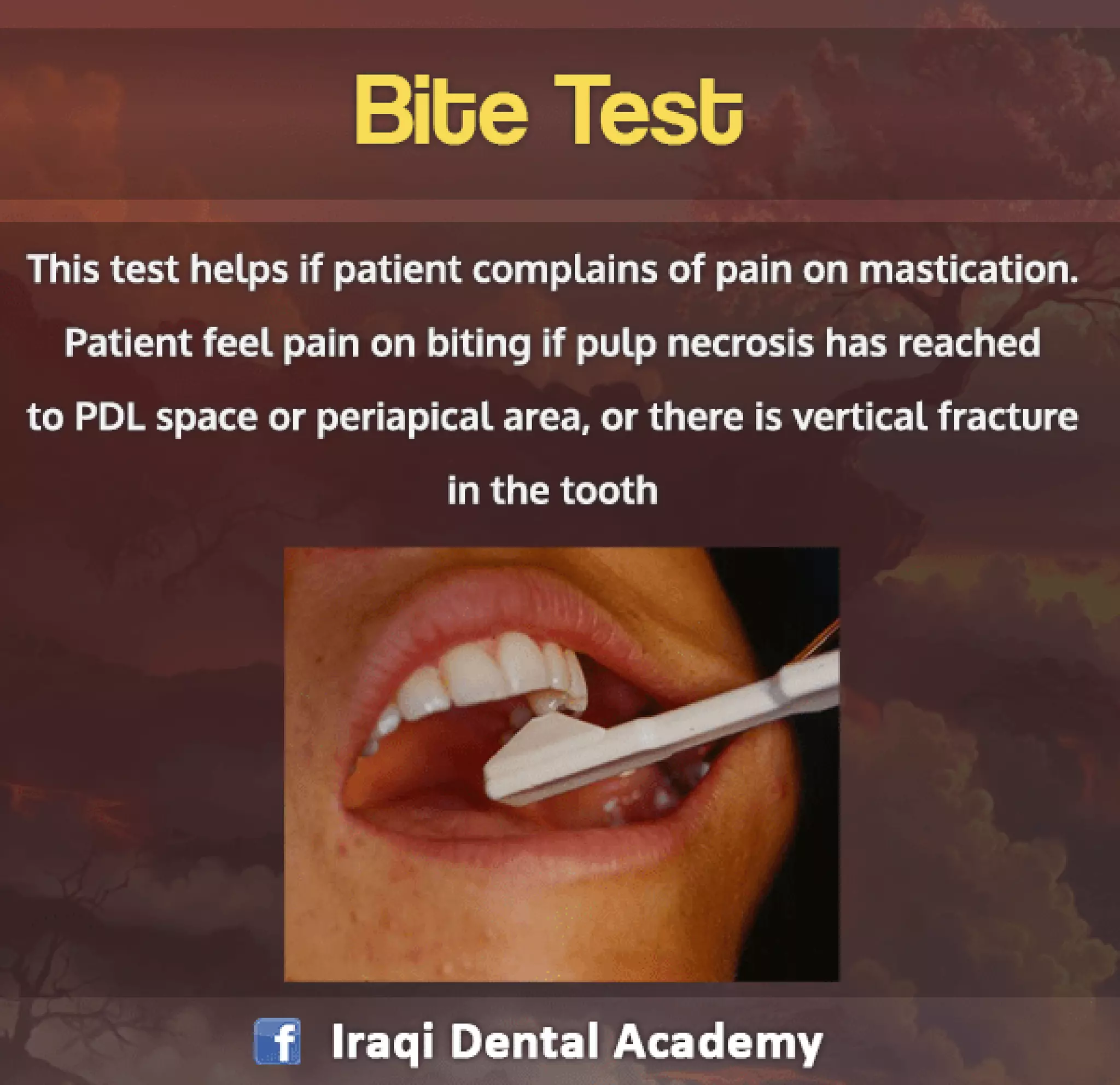 Endodontic Diagnosis: Pulp Vitality Tests | PDF