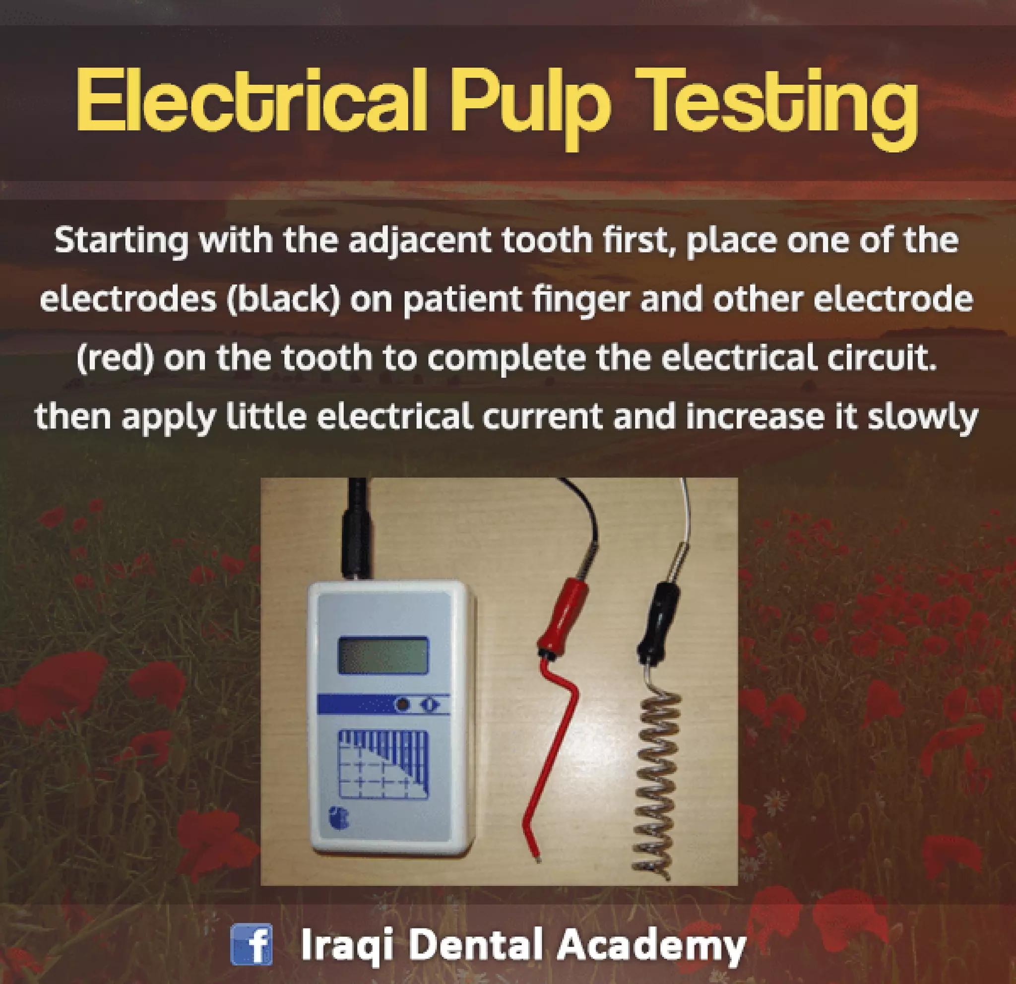 Endodontic Diagnosis: Pulp Vitality Tests | PDF