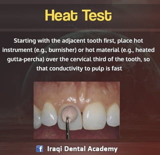 Endodontic Diagnosis: Pulp Vitality Tests | PDF