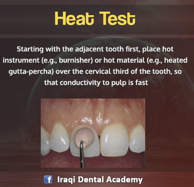 Endodontic Diagnosis: Pulp Vitality Tests | PDF | Dental Health ...