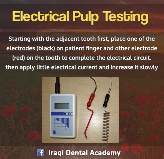 Endodontic Diagnosis: Pulp Vitality Tests | PDF | Dental Health ...