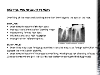 Endodontic emergencies | PPTX
