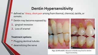 Endodontic Emergencies.pptxEndodontic Emergencies.pptx