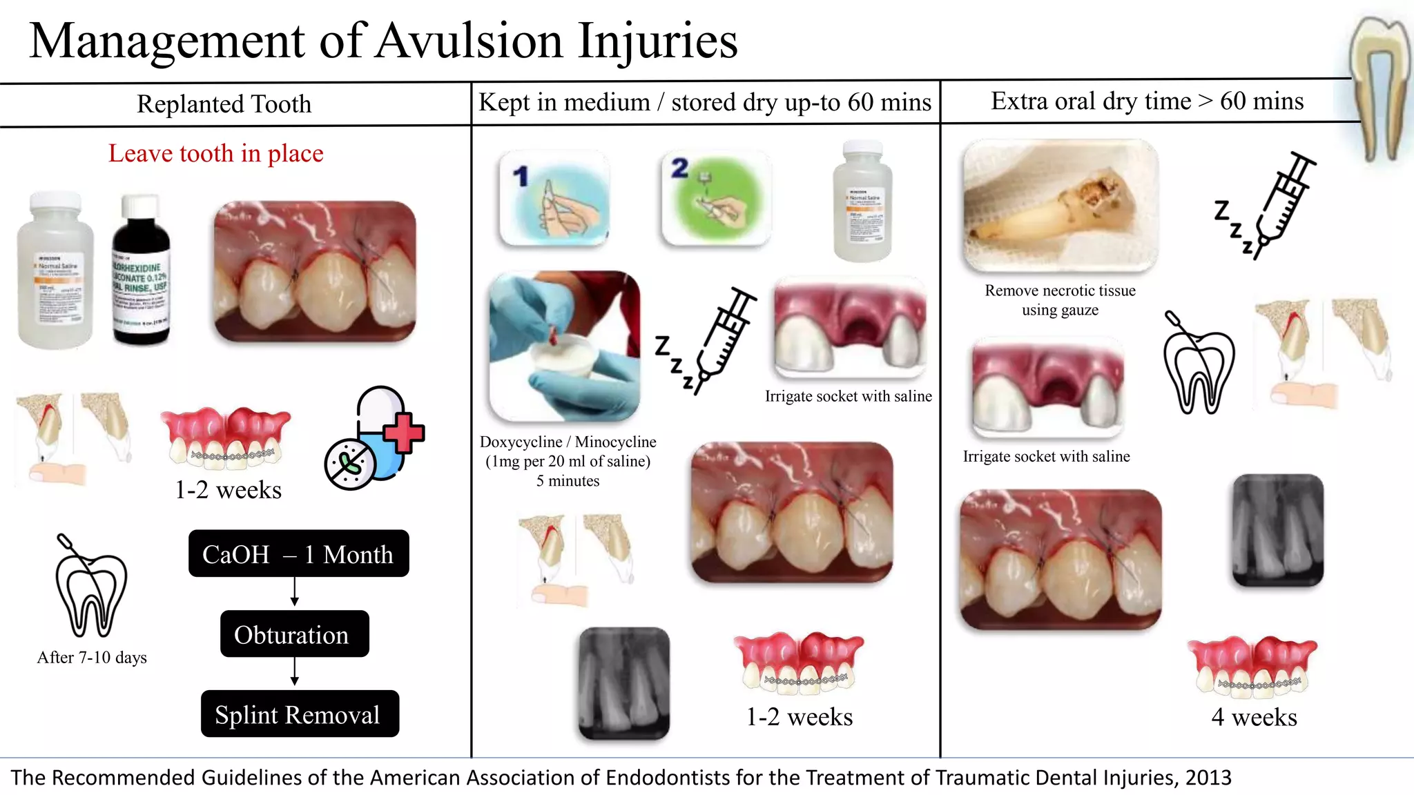 Endodontic Emergencies | PPTX