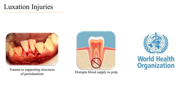 Endodontic Emergencies | PPTX | Dental Health | Diseases and Conditions