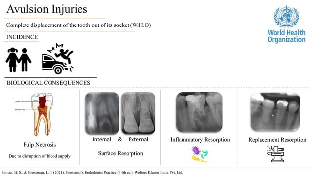 Endodontic Emergencies | PPTX | Dental Health | Diseases and Conditions