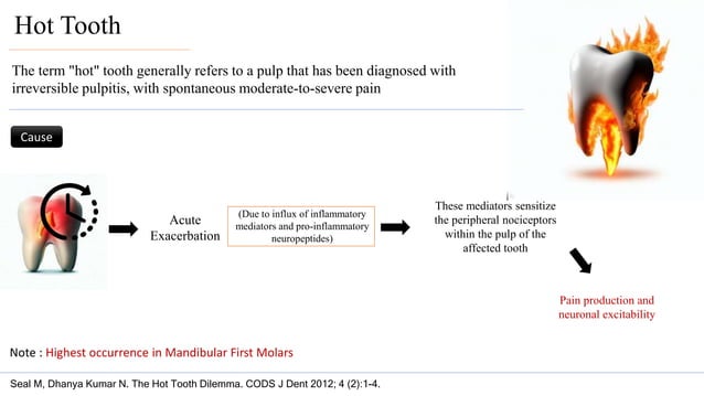 Endodontic Emergencies | PPTX | Dental Health | Diseases and Conditions