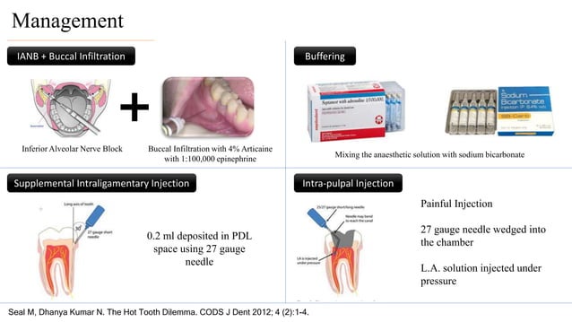 Endodontic Emergencies | PPTX | Dental Health | Diseases and Conditions