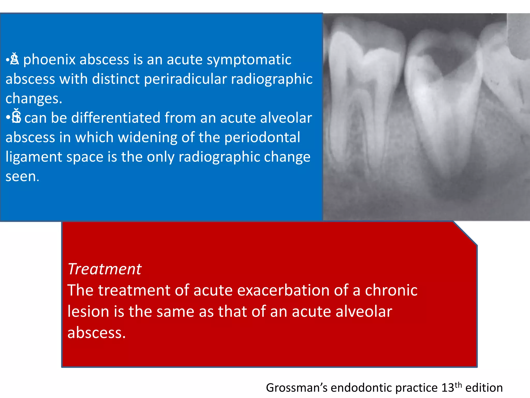 ENDODONTIC EMERGENCIES | PPTX