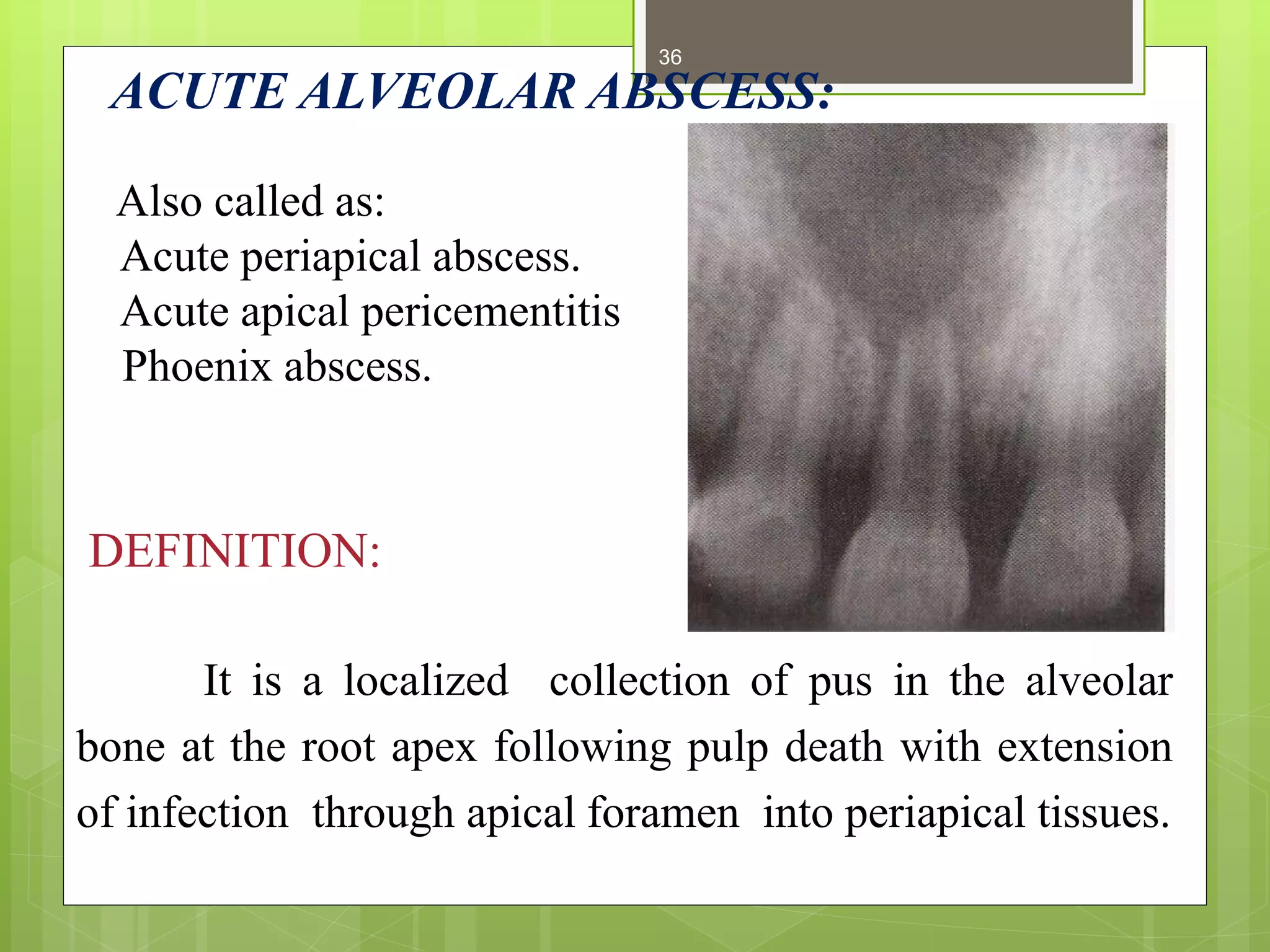 Endodontic emergencies | PPTX