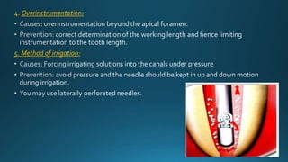 Endodontic emergency | PPTX