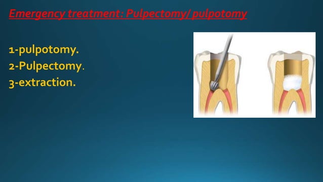 Endodontic emergency | PPTX