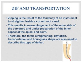 Endodontic Errors | PPTX
