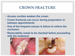 Endodontic Errors | PPTX