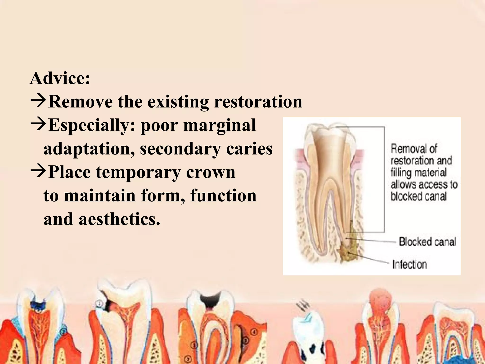 Endodontic failures | PPT