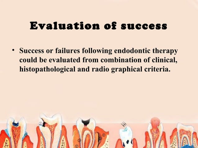 Cracked Tooth Syndrome Terapia Endorestaurativa Shapeit Endo