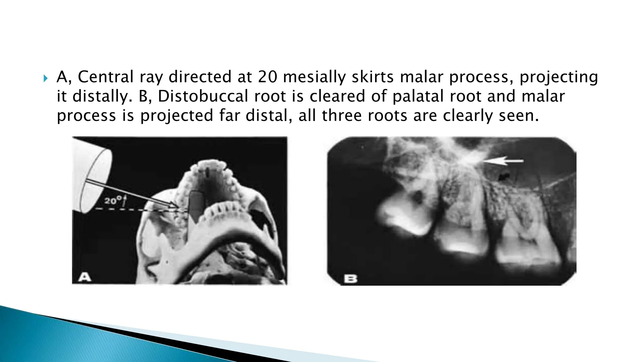 Conservative Dentistry and Endodontic Imaging | PPTX