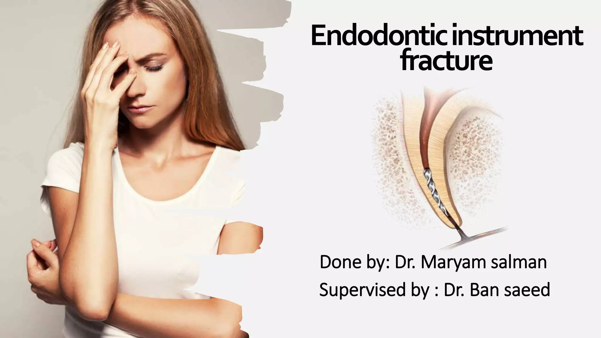Endodontic instrument fracture and thier management by dr.maryam salman ...