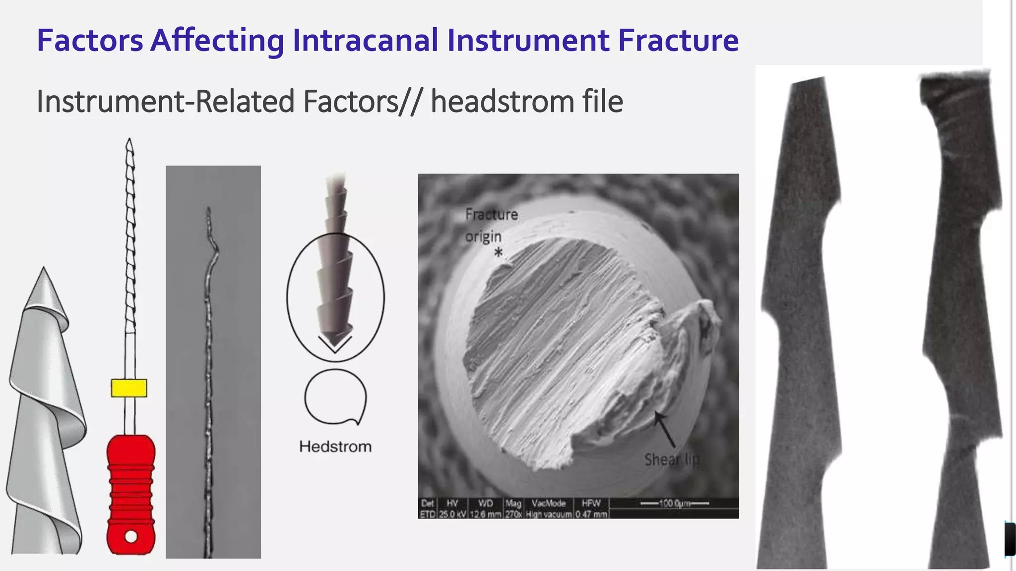 Endodontic instrument fracture and thier management by dr.maryam salman ...