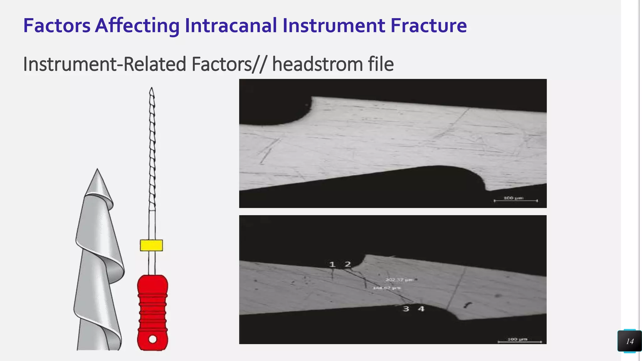 Endodontic instrument fracture and thier management by dr.maryam salman ...