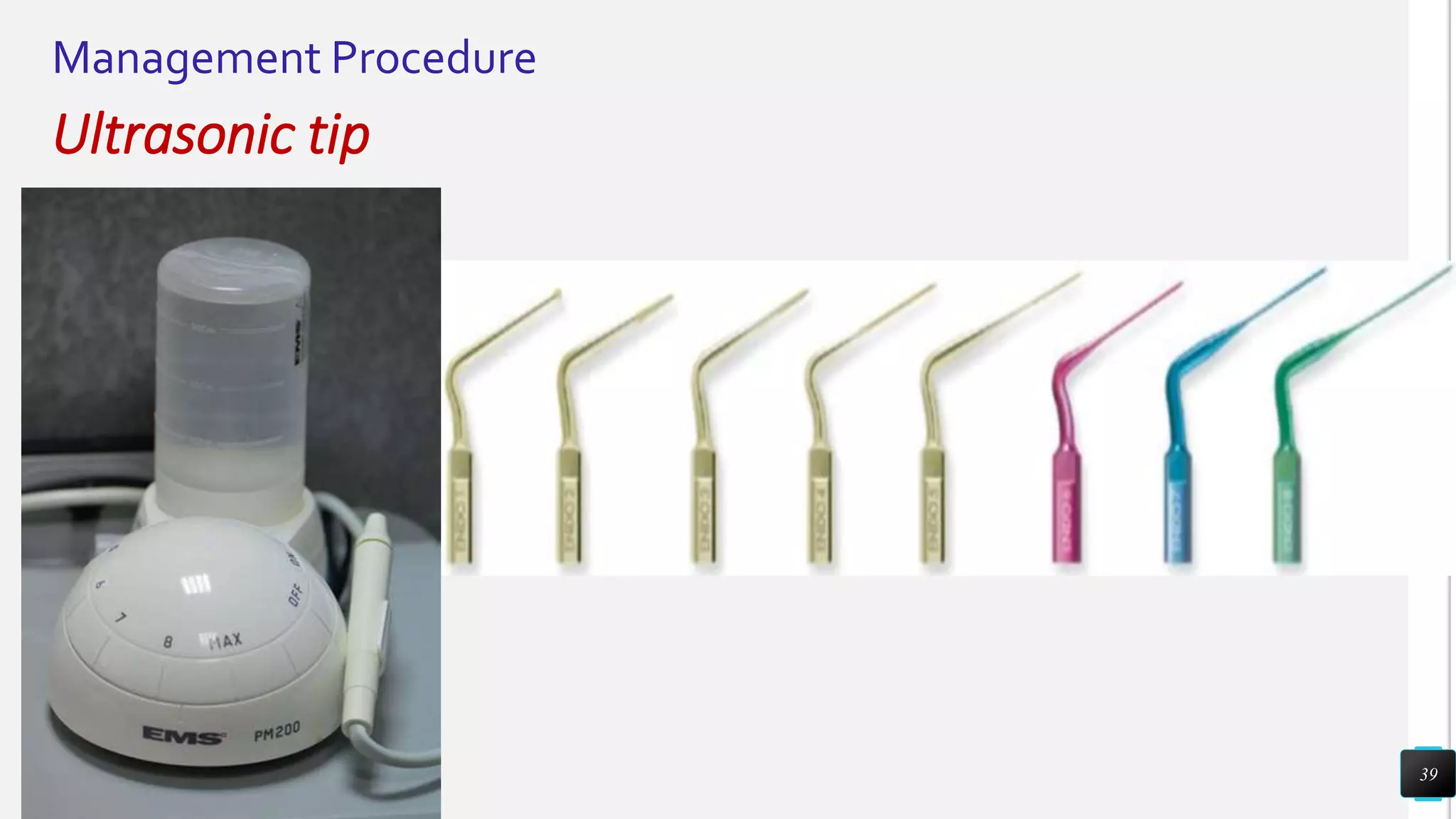 Endodontic instrument fracture and thier management by dr.maryam salman | PPTX