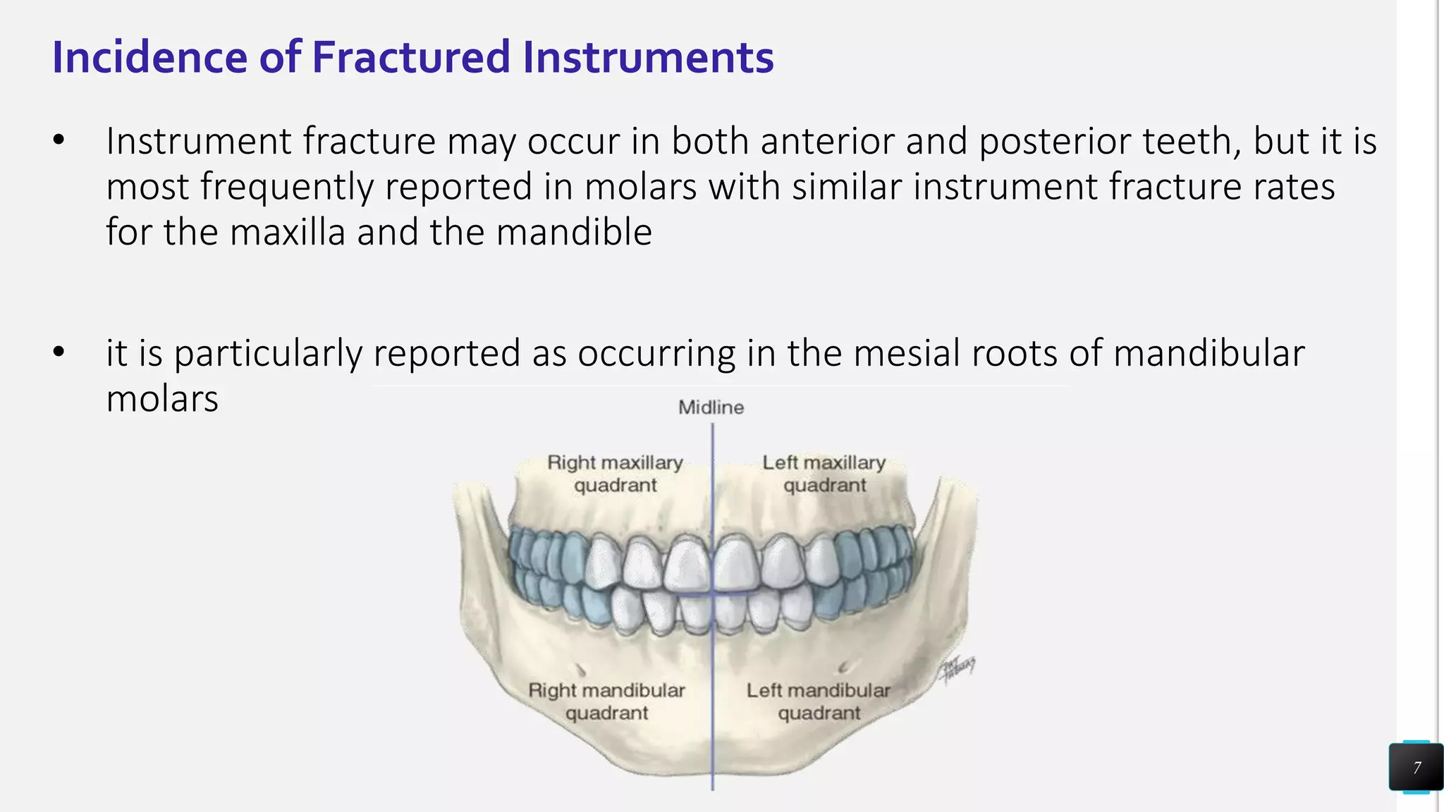Endodontic instrument fracture and thier management by dr.maryam salman ...