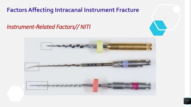 Endodontic instrument fracture and thier management by dr.maryam salman ...