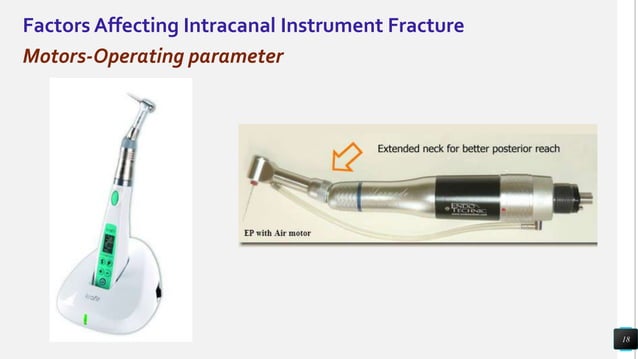 Endodontic instrument fracture and thier management by dr.maryam salman ...