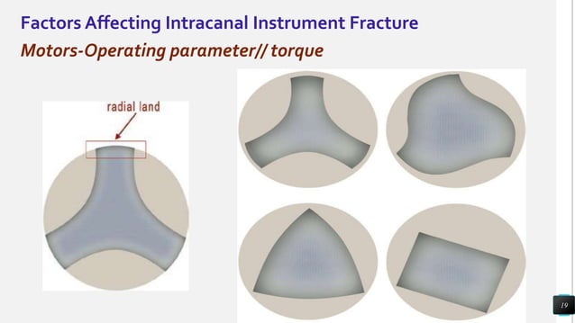 Endodontic instrument fracture and thier management by dr.maryam salman ...