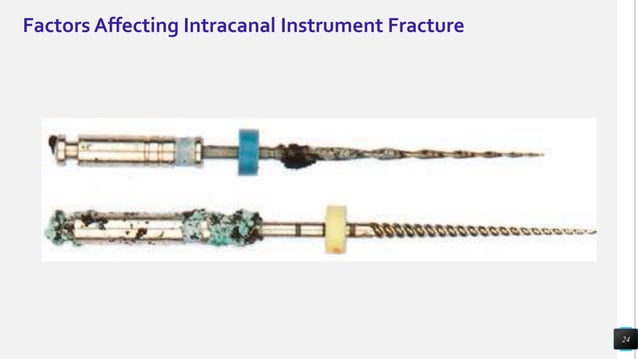 Endodontic instrument fracture and thier management by dr.maryam salman ...