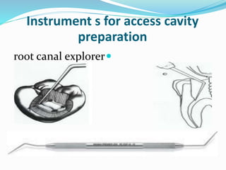 Endodonticinstruments 130320105634-phpapp01 | PPTX