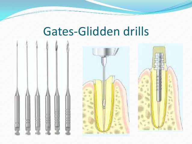 Endodontic instruments