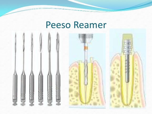 Endodontic instruments