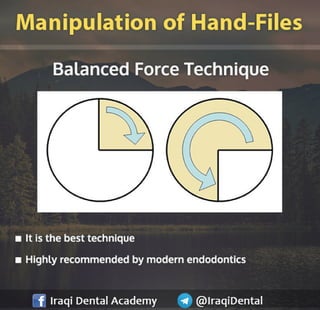 Basic Endodontic Instruments Presentation | PDF