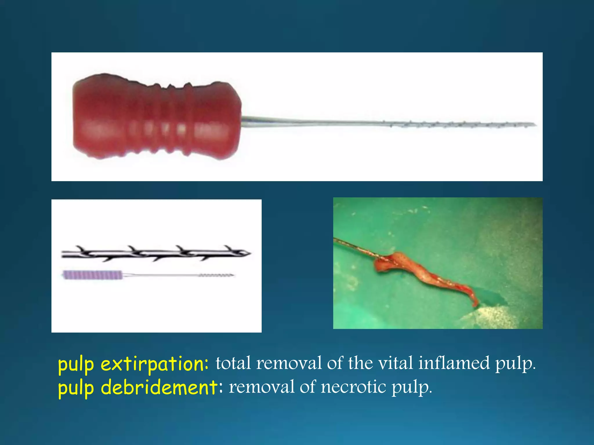 Endodontic instruments 1 | PPTX